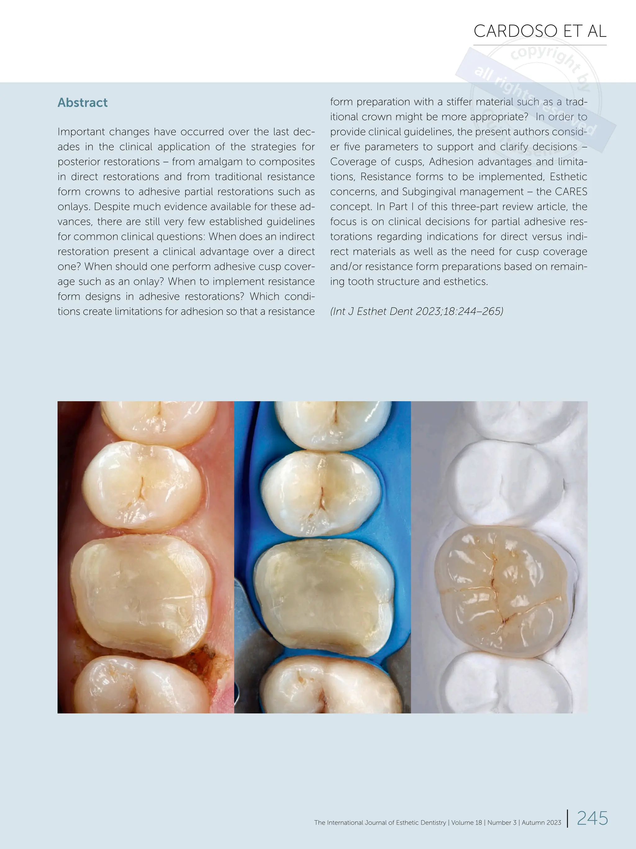 2023 Clinical guidelines for posterior restorations based on Coverage ...