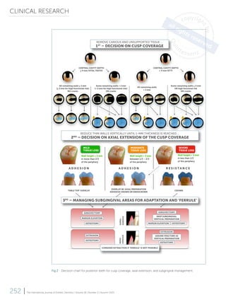 2023 Clinical guidelines for posterior restorations based on Coverage ...