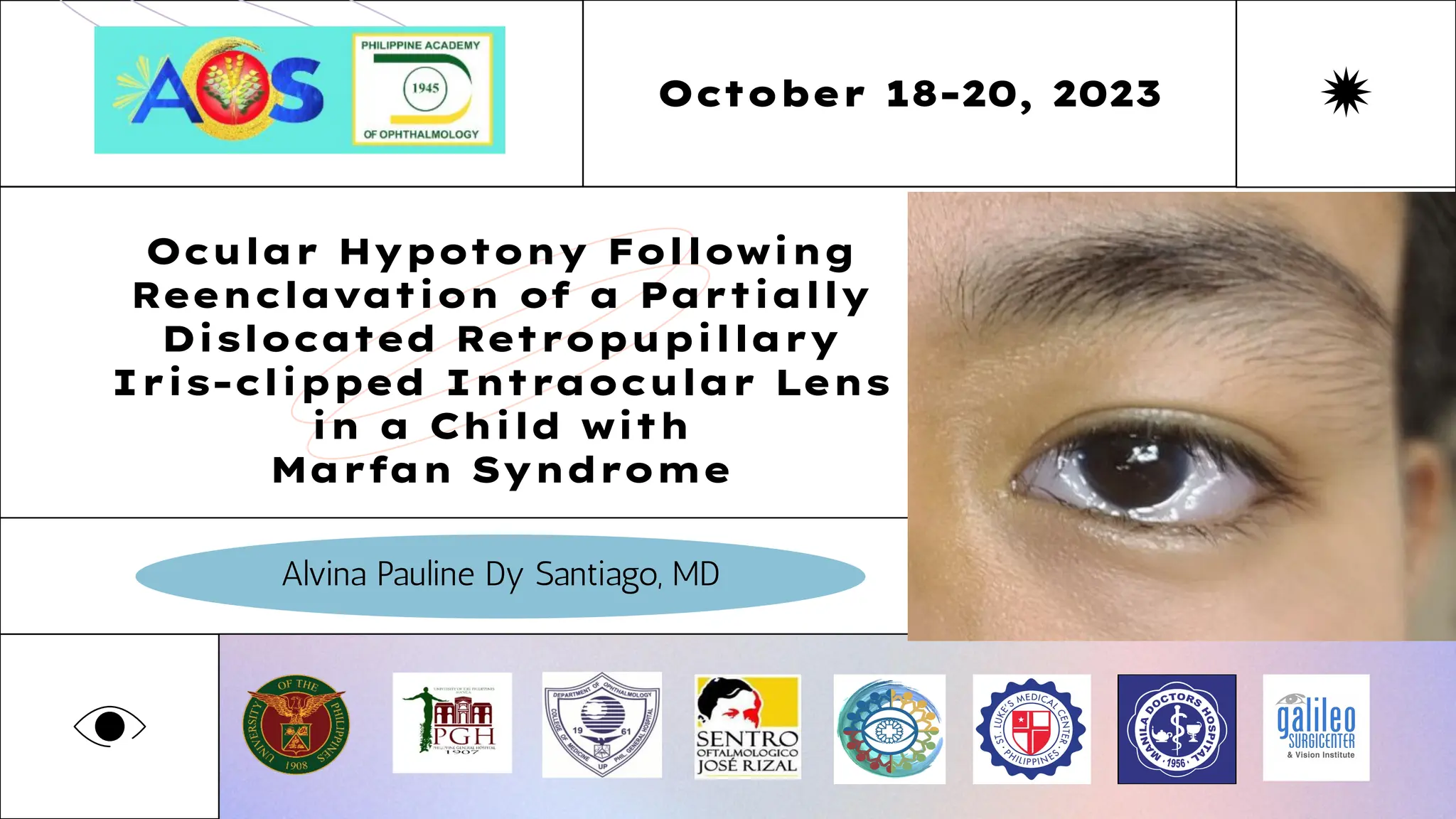 Ocular hypotony following reenclavation of a partially dislocated ...