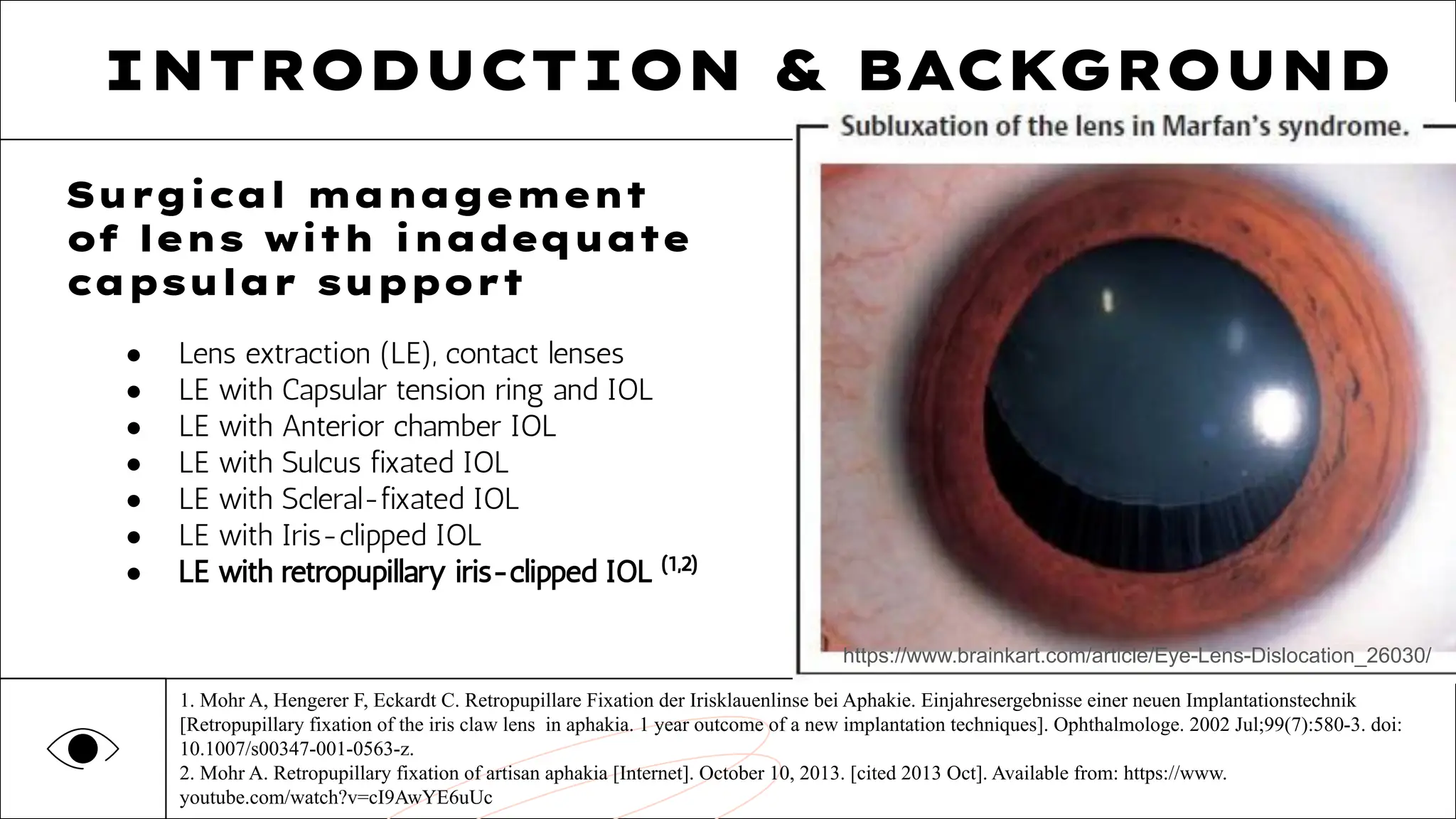 Ocular hypotony following reenclavation of a partially dislocated ...