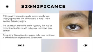 Ocular hypotony following reenclavation of a partially dislocated ...