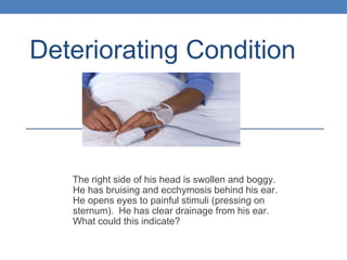2023_Sp_Neuro Case Study_Acute Intracranial Problems-1.pptx