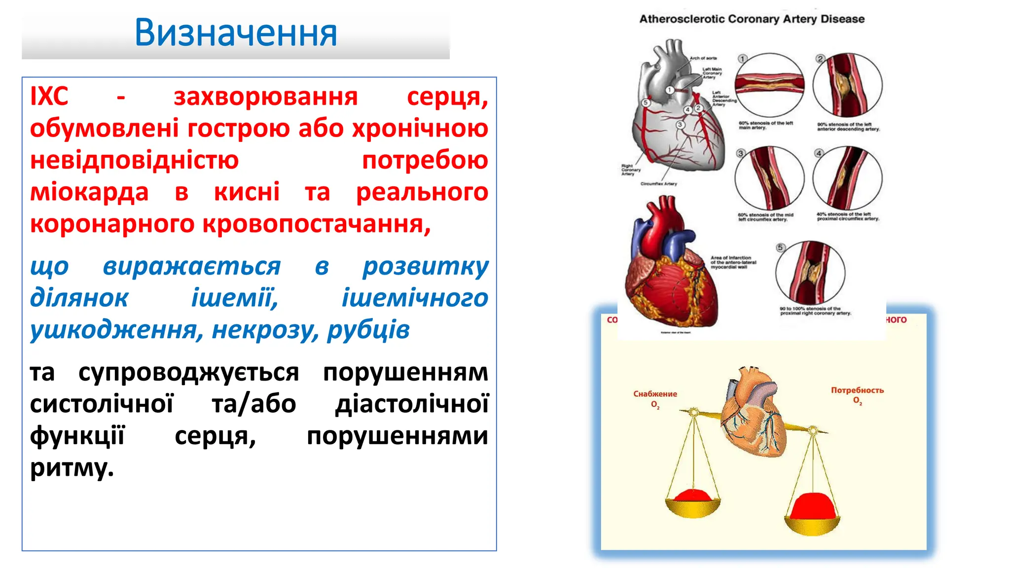 ISCHEMIC HEART DISEASE Angina. Myocardial infarction | PPT