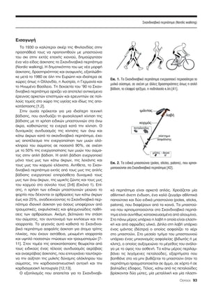 Σκανδιναβικό περπάτημα (Nordic walking) Οστούν 2024; 31(3) 92-100.pdf