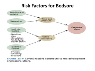 Pressure Ulcers A decubitus ulcer. Stages of Bedsore | PDF
