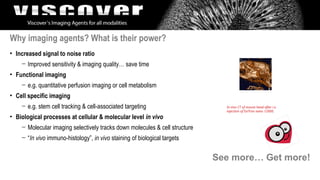 Witness the Power of Contrast Agents & Multimodal Imaging: MRI ...