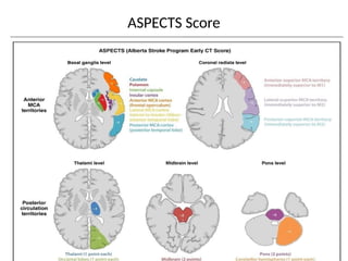2026 AHA/ASA Guidelines for Early Management of Acute Ischemic Stroke ...