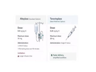 2026 AHA/ASA Guidelines for Early Management of Acute Ischemic Stroke ...