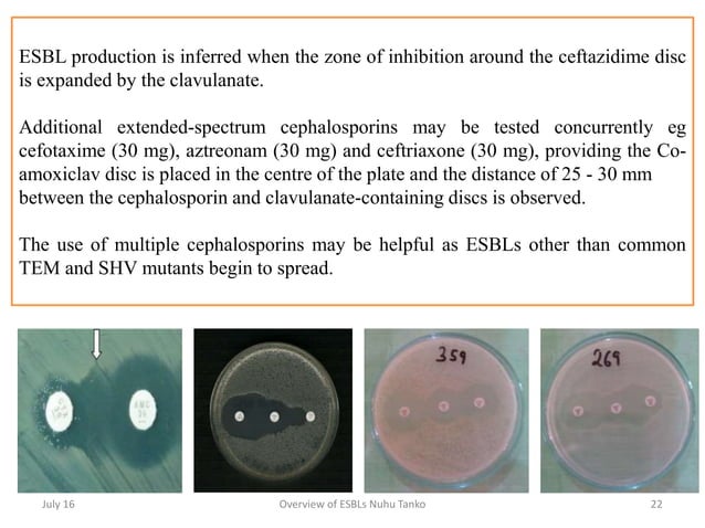 LECTURES SERIES ESBLs | PPTX