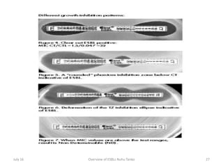 LECTURES SERIES ESBLs | PPTX