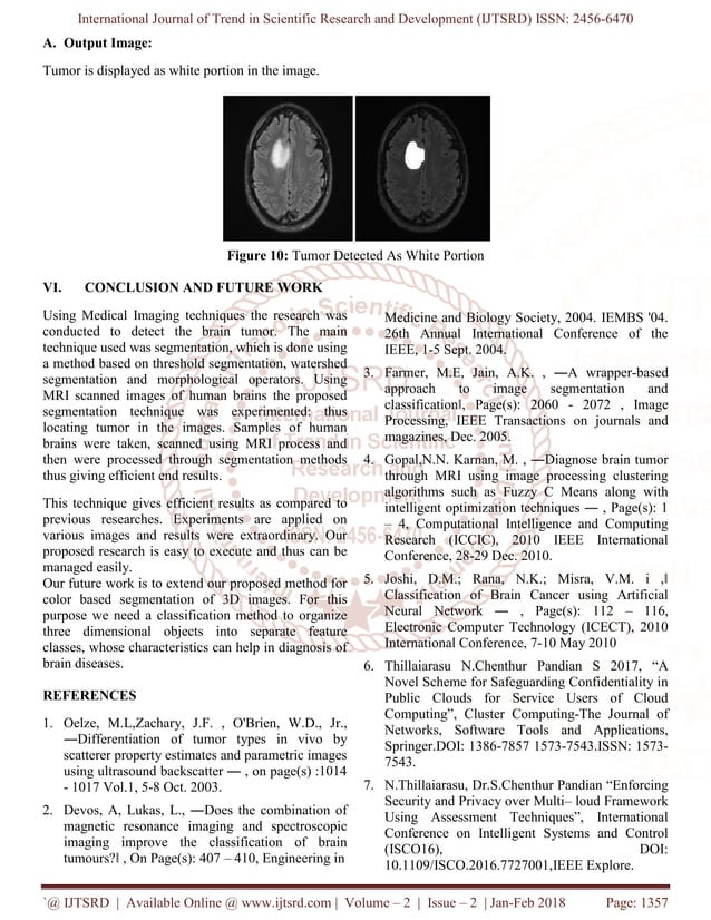 An Efficient Brain Tumor Detection Algorithm based on Segmentation for MRI System | PDF