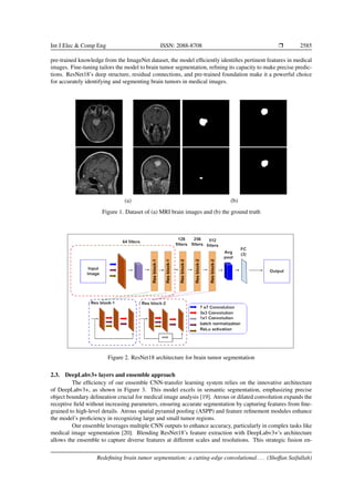 Redefining brain tumor segmentation: a cutting-edge convolutional neural networks-transfer ...