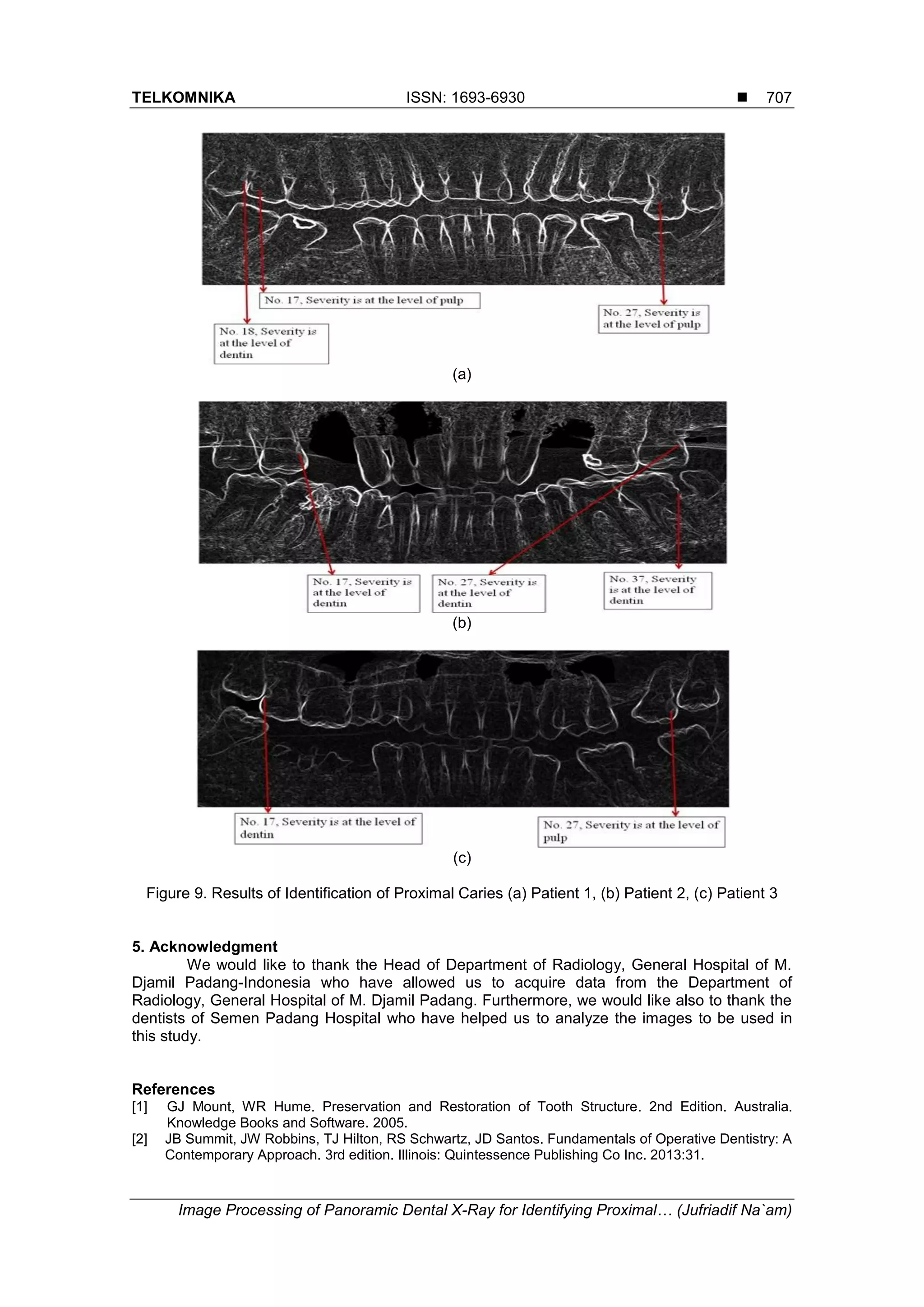 Image Processing of Panoramic Dental X-Ray for Identifying Proximal ...