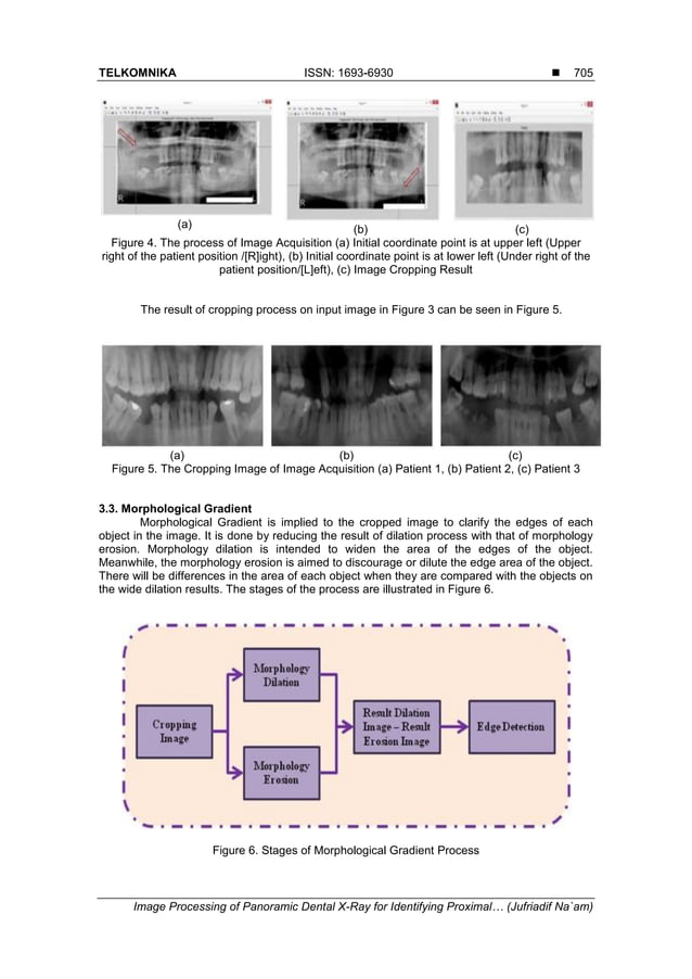 Image Processing of Panoramic Dental X-Ray for Identifying Proximal ...