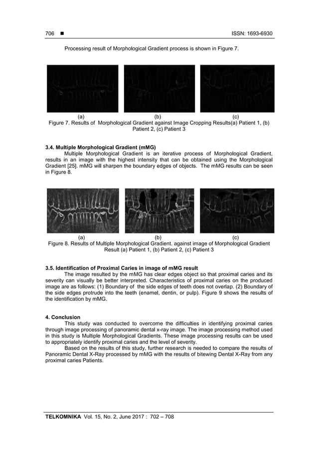Image Processing of Panoramic Dental X-Ray for Identifying Proximal ...