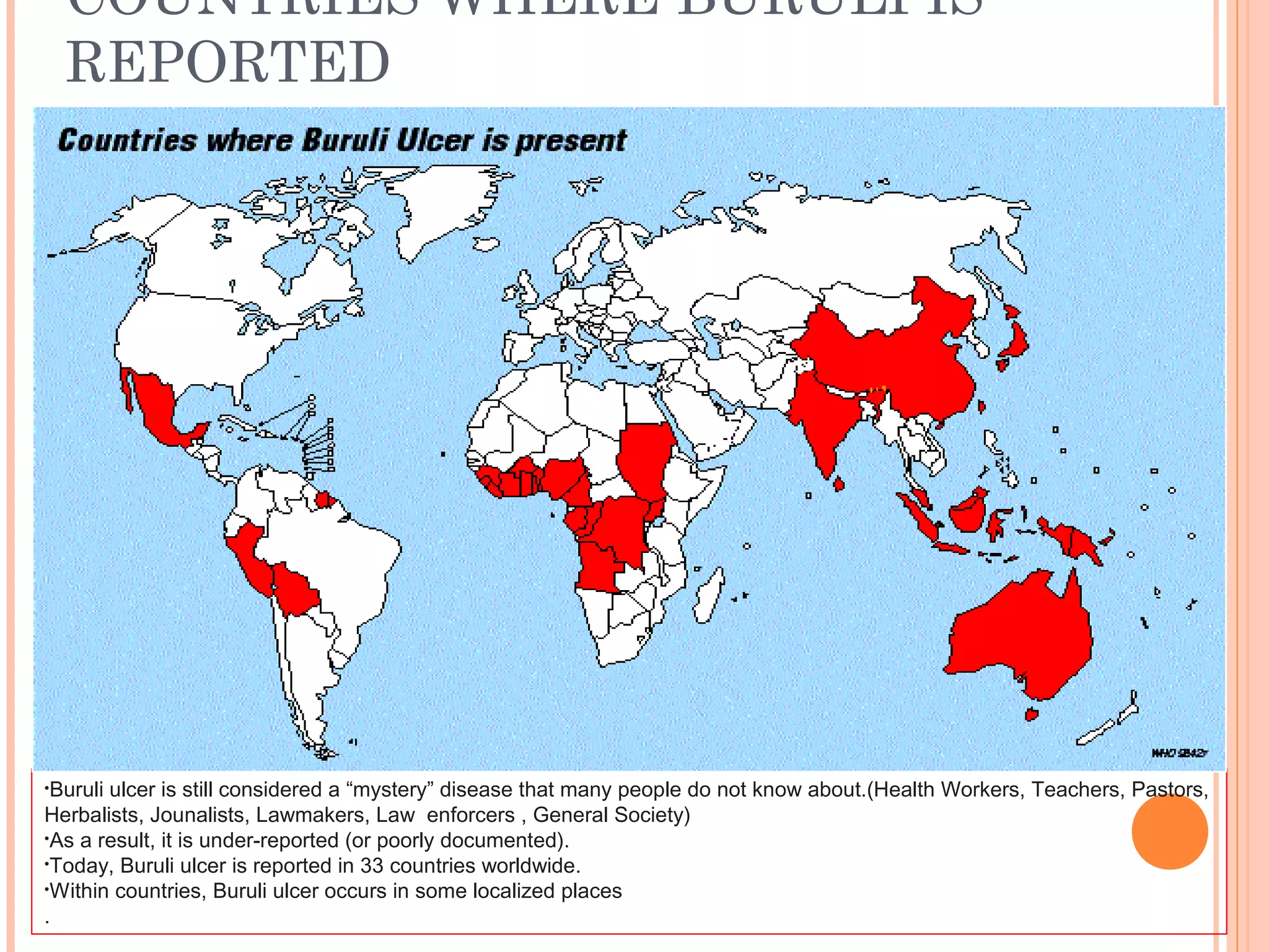 Presentation On Buruli Ulcer | PPT