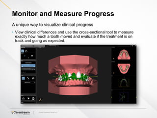 Introducing CS Model+ v4 | PPT