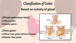 208 goiter | PPT