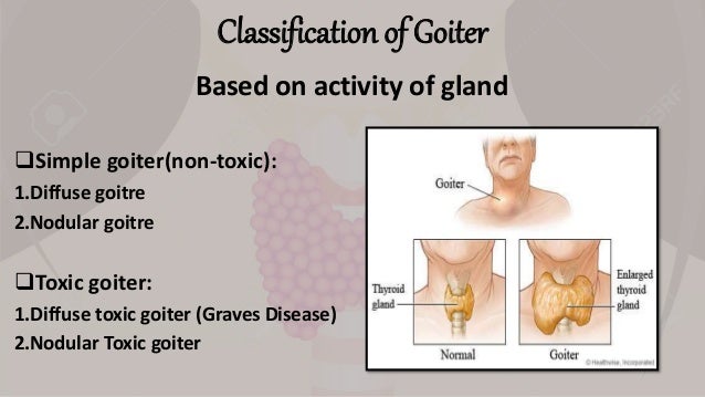 208 goiter