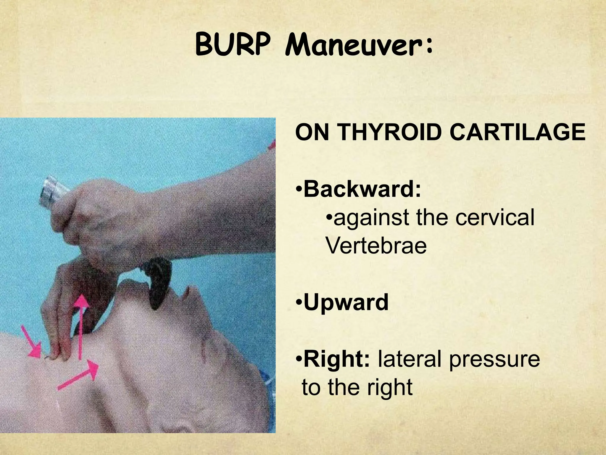 209415893-Endotracheal-tube-insertion-ppt.pptx
