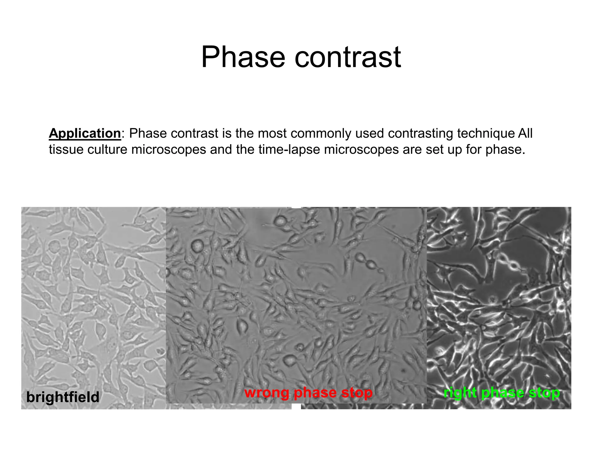 Microscopy and staining techniques details | PPT