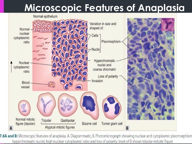 Tumor biology