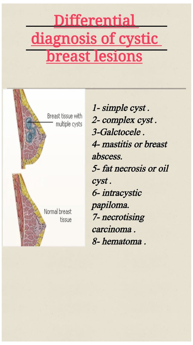 Cystic lesions of the breast | PDF
