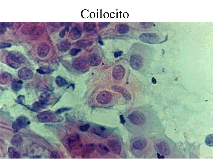 20b vce wwwipogcombrimageshtm