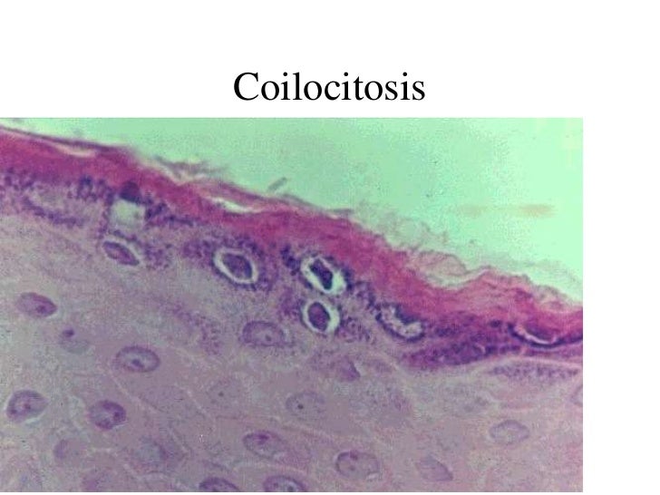 20b vce wwwipogcombrimageshtm