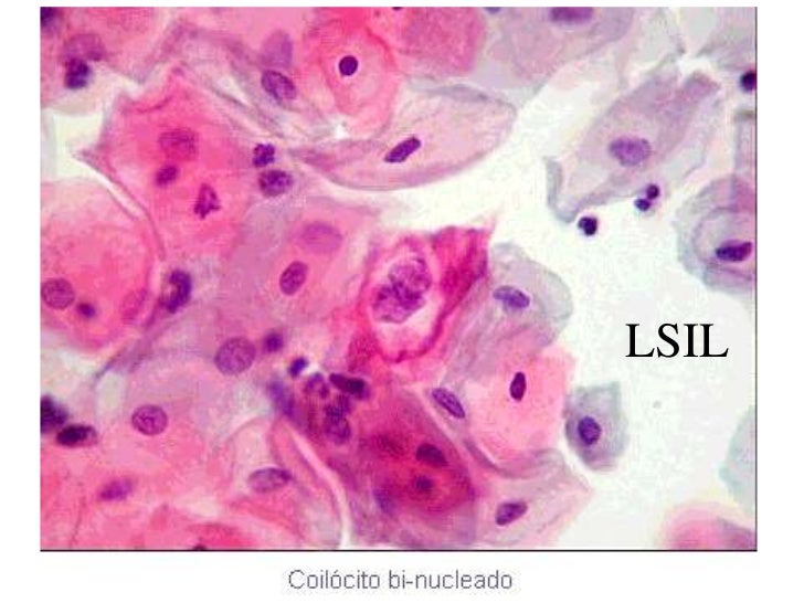 20b vce wwwipogcombrimageshtm