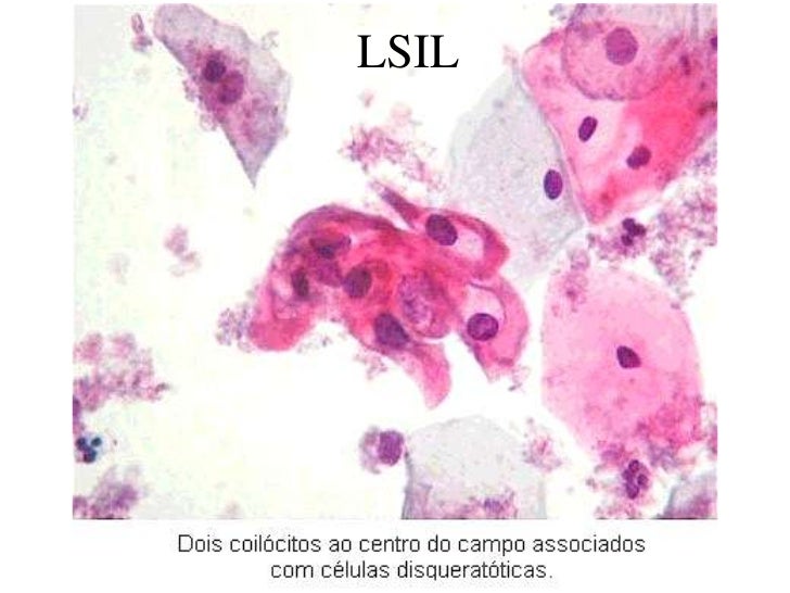 20b vce wwwipogcombrimageshtm