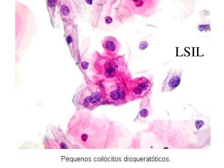 20b vce wwwipogcombrimageshtm