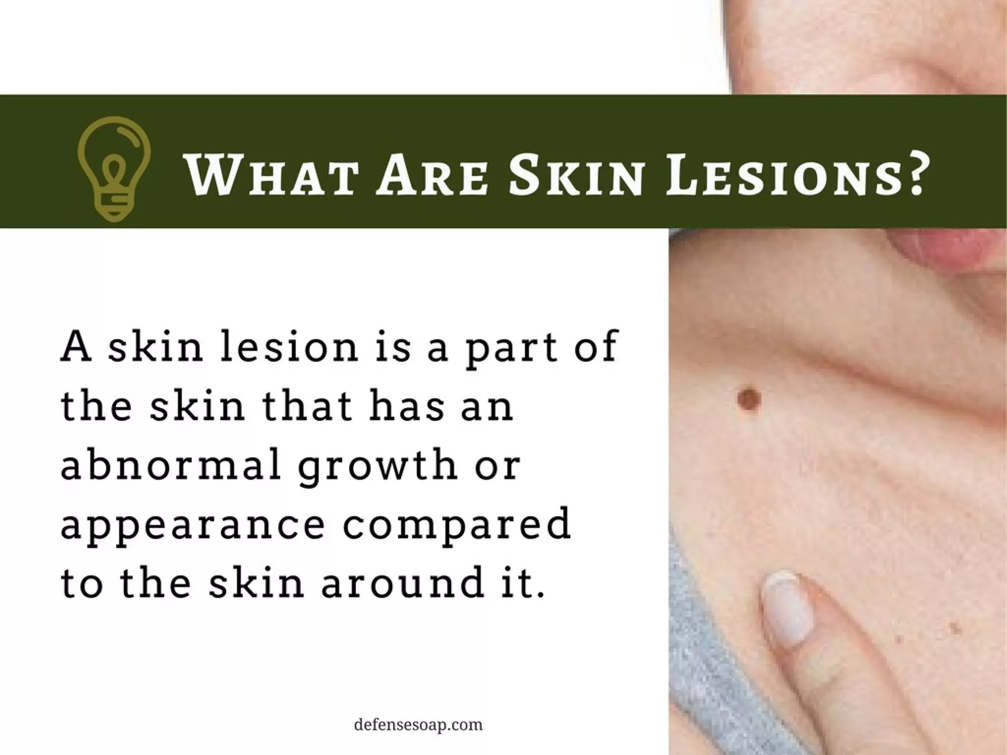 20 Common Skin Lesions | PPT