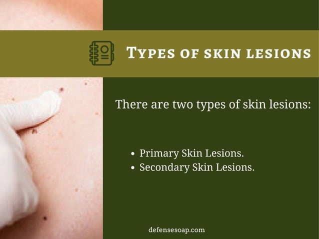 20 Common Skin Lesions | PPT