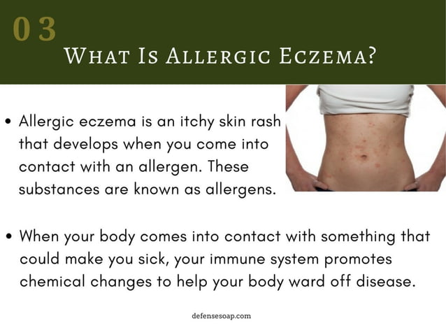 20 Common Skin Lesions | PPT