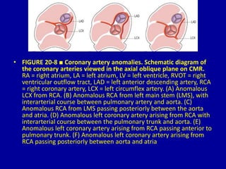 20 congenital heart disease Dr. Muhammmad Bin Zulfiqar | PPTX