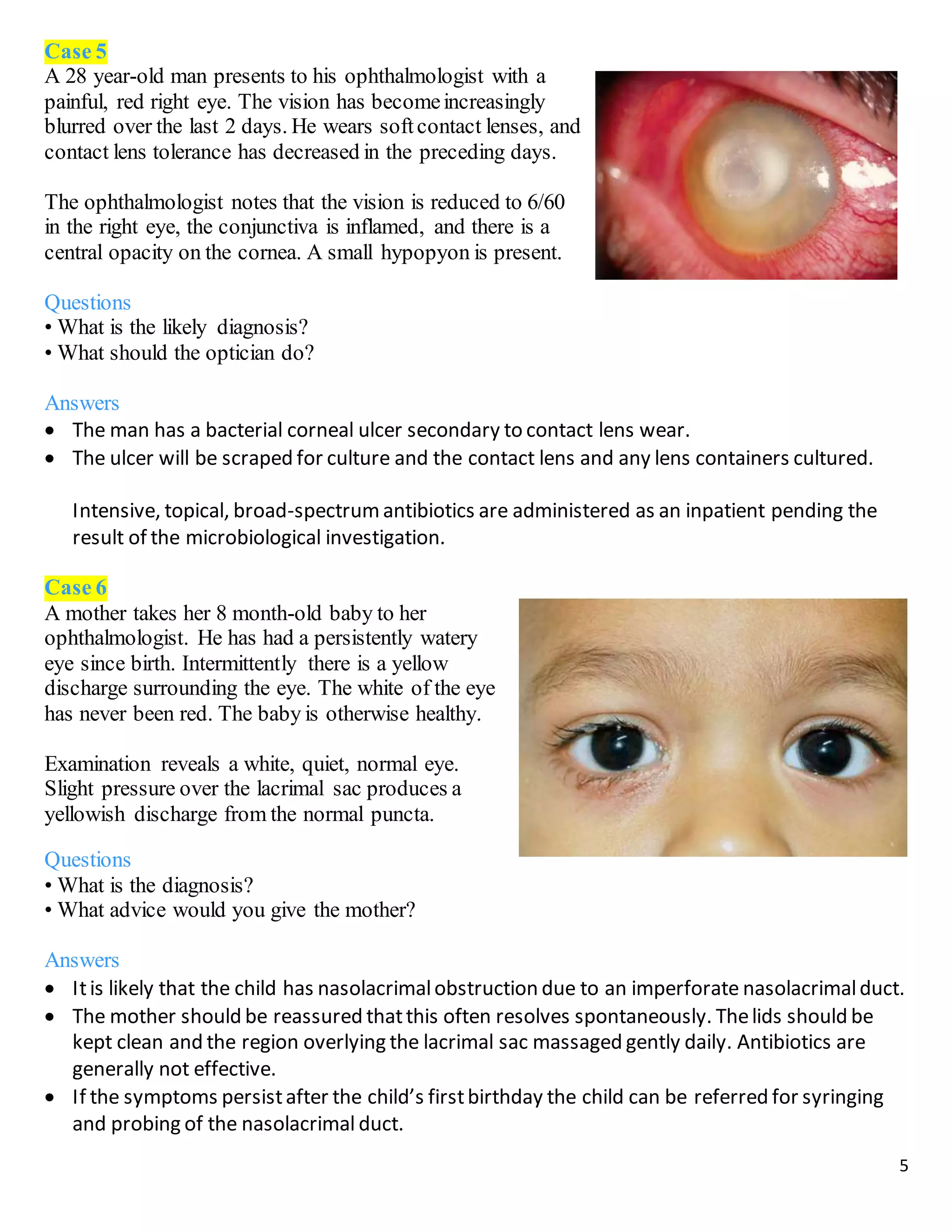 20 ophthalmology clinical cases | DOCX