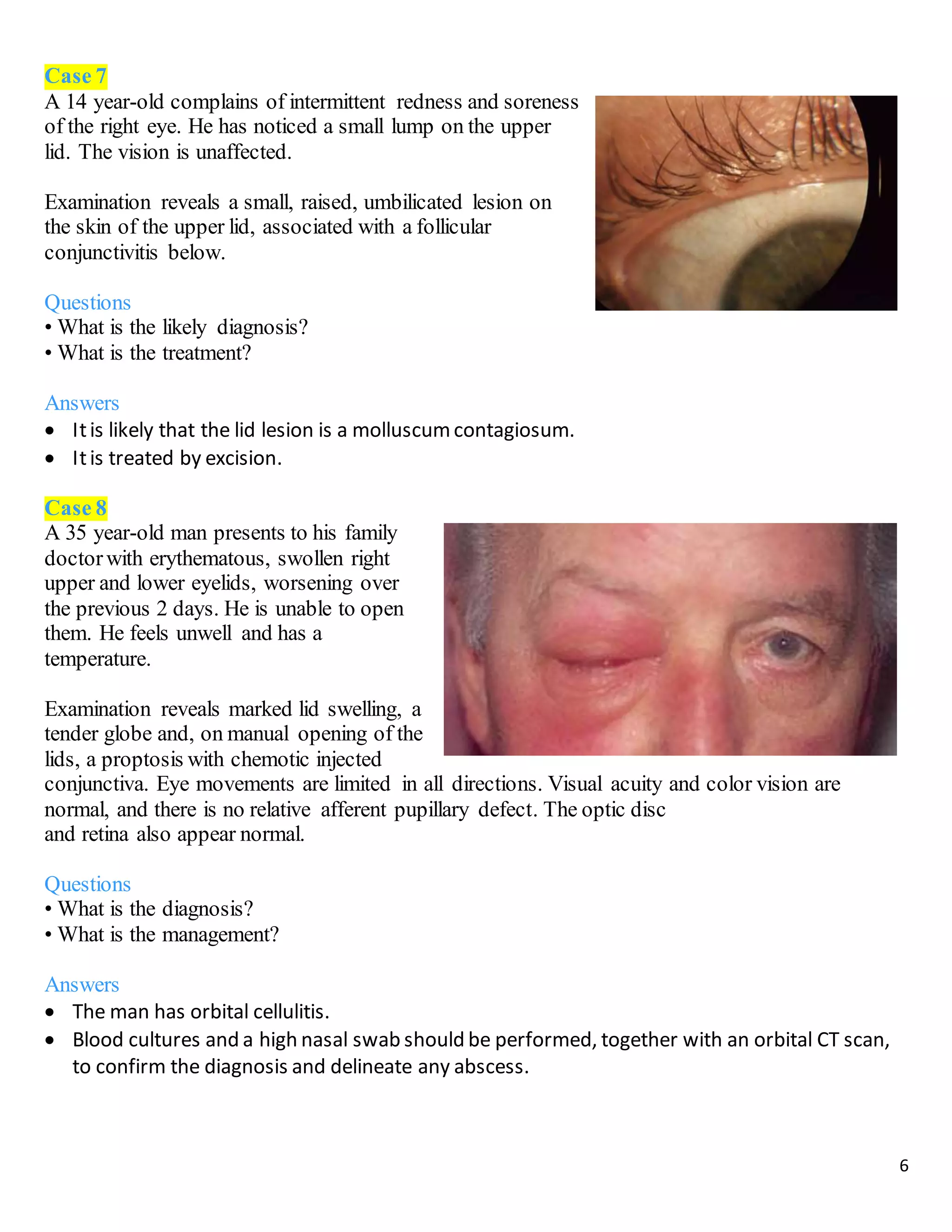 20 ophthalmology clinical cases | DOCX