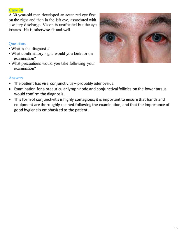 20 ophthalmology clinical cases | DOCX | Eye and Vision Conditions ...