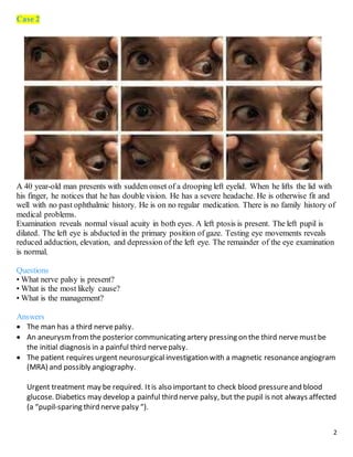 20 ophthalmology clinical cases | DOCX