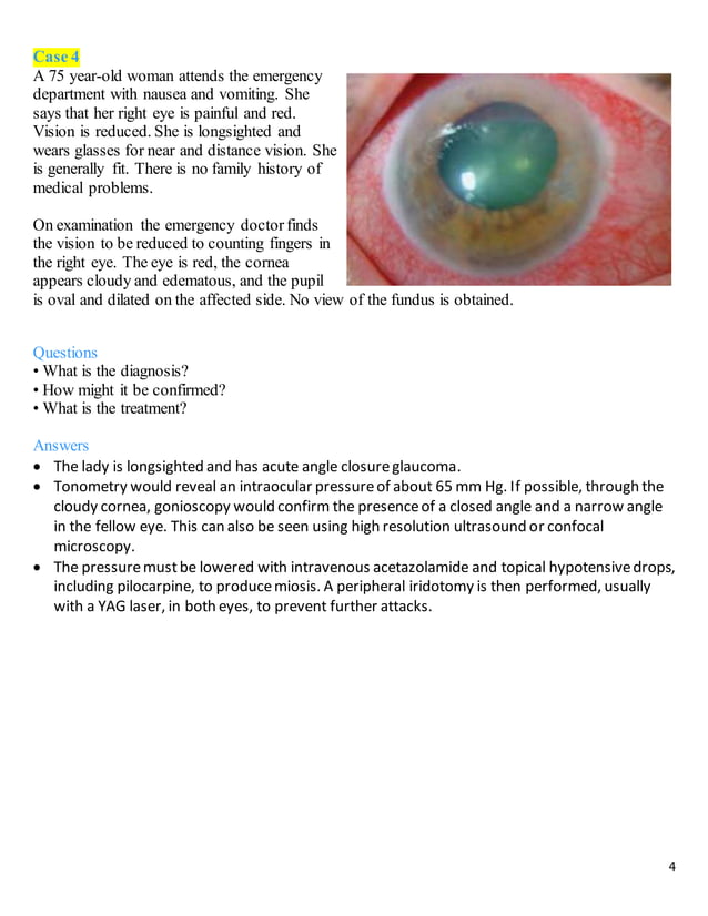 20 ophthalmology clinical cases | DOCX | Eye and Vision Conditions ...