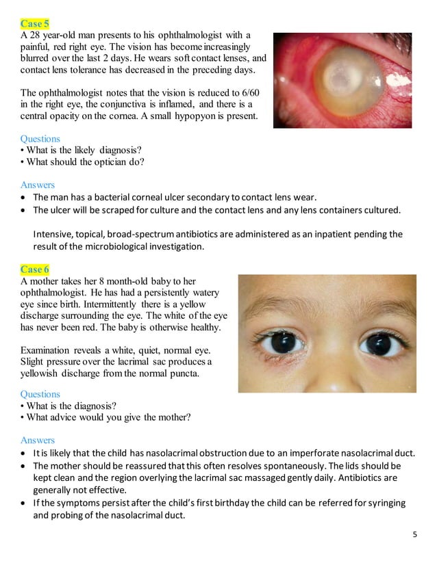 20 ophthalmology clinical cases | DOCX | Eye and Vision Conditions ...