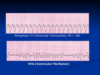 20 patient monitoring | PPT
