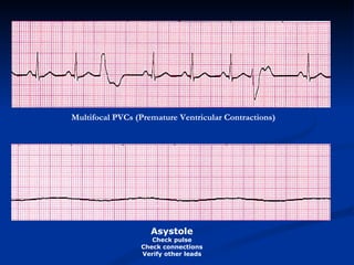 20 patient monitoring | PPT