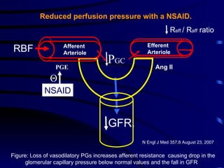 20 Saxena Acute Renal Failure | PPT