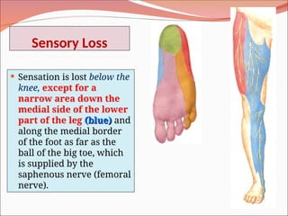 SCIATIC NERVE SCIATIC NERVE SCIATIC NERV | PPT
