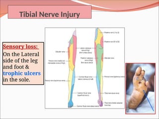SCIATIC NERVE SCIATIC NERVE SCIATIC NERV | PPT