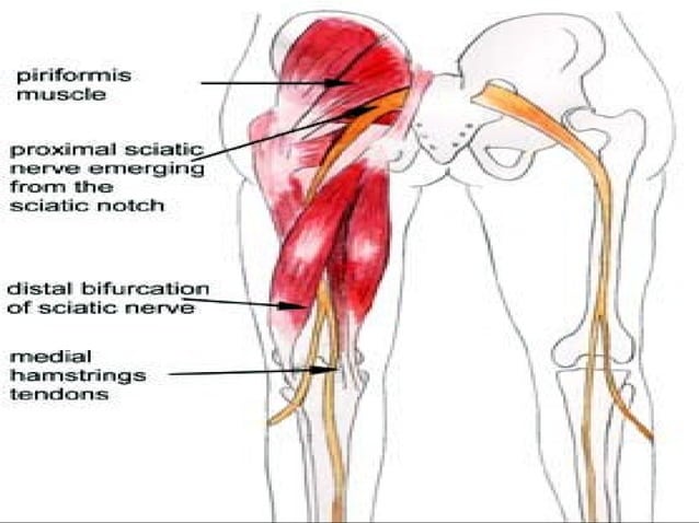 SCIATIC NERVE SCIATIC NERVE SCIATIC NERV | PPT