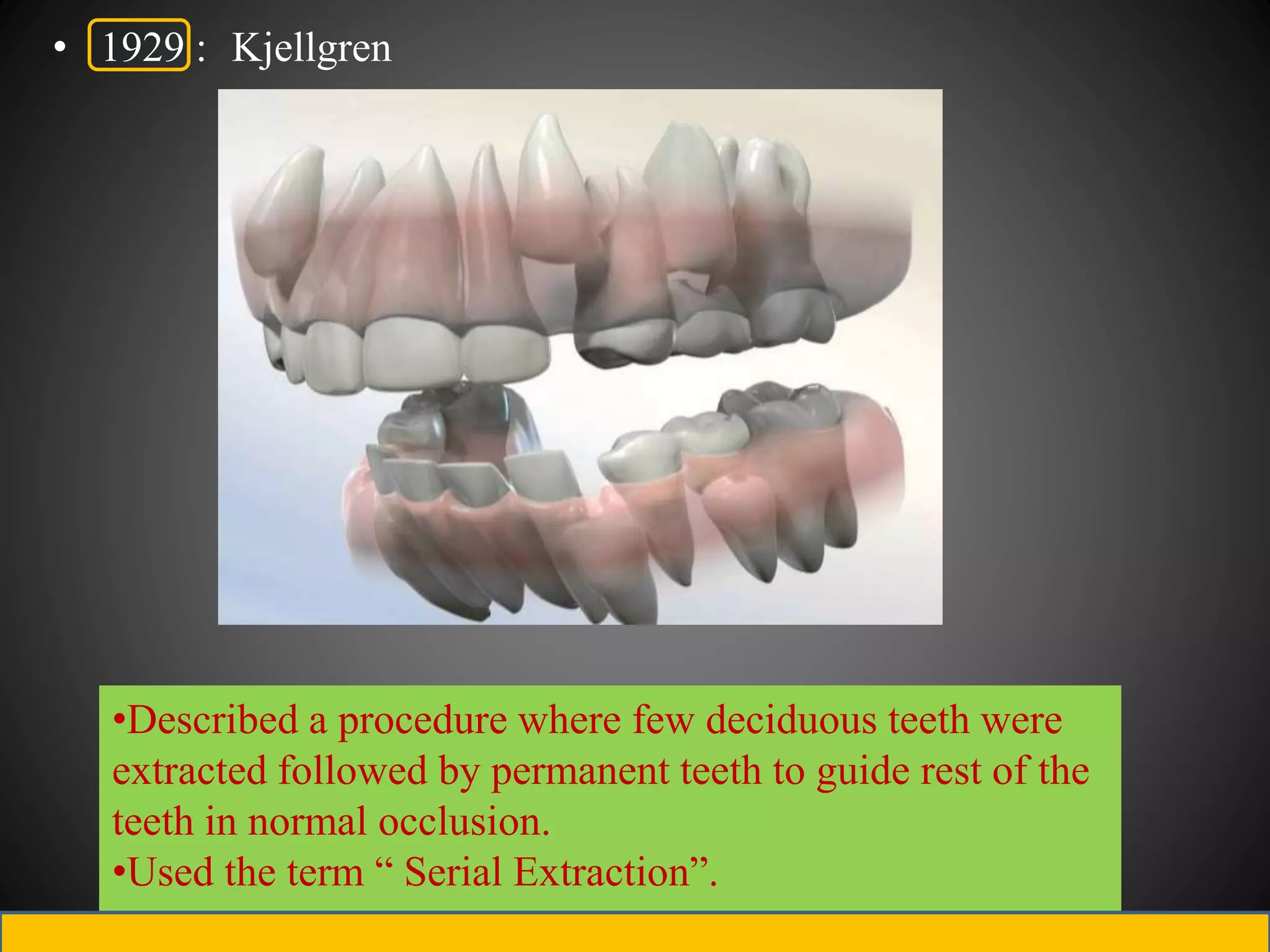History of dentistry: 20th century | PPTX