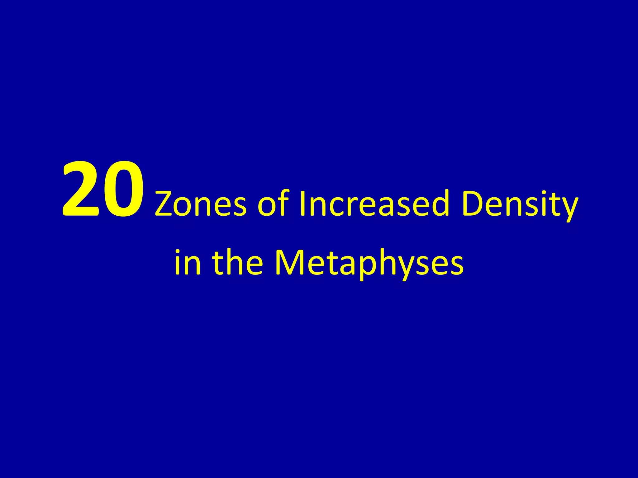 20 zones of increased density in the metaphyses | PPTX